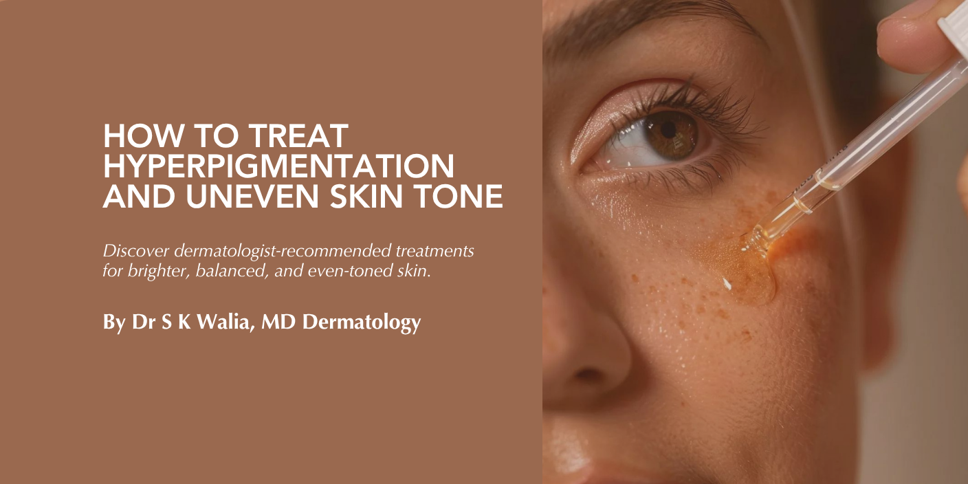 How to Treat Hyperpigmentation – Dermatologist Tips – Molekulaire